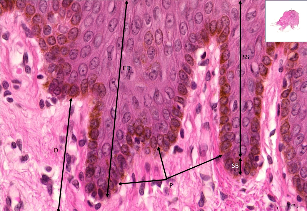 Scrotum / Pigmented skin of scrotum - HE – WikiSkripta