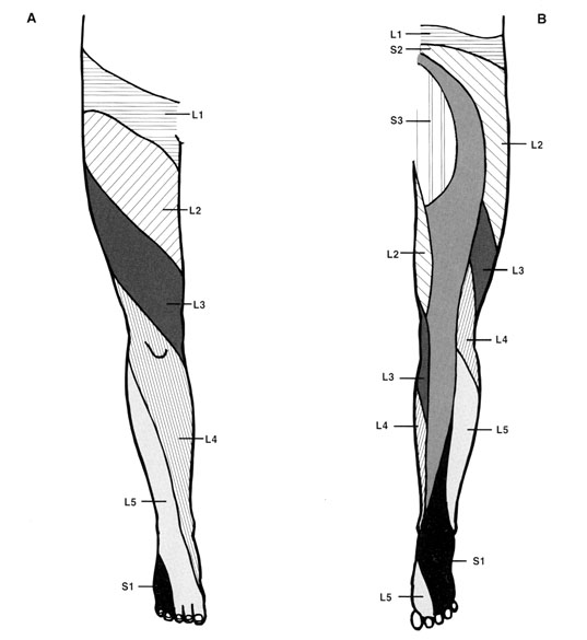 Bolesti zad, kořenové syndromy na dolních končetinách/PGS – WikiSkripta