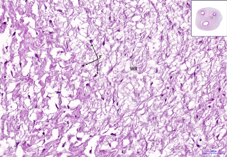 Pupečník / Umbilical cord - HE – WikiSkripta