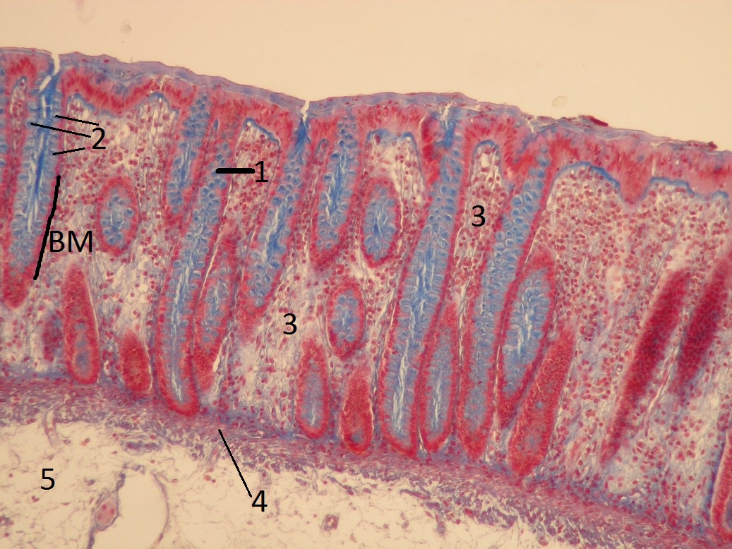 The large intestine (specimen) - WikiLectures