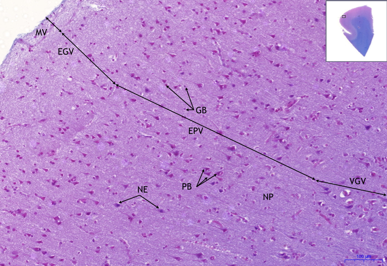 Mozek / Cerebrum - Myelin – WikiSkripta