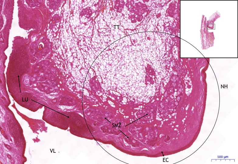 Larynx - HE – WikiSkripta