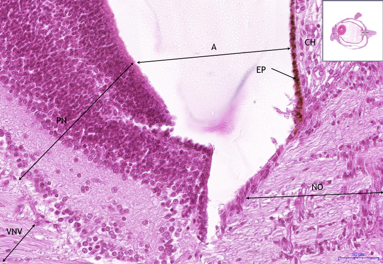 Bulbus oculi - HE – WikiSkripta