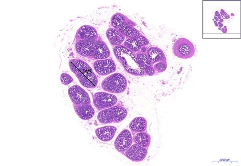 Vesicula seminalis - HE – WikiSkripta