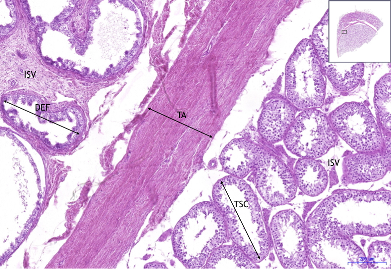 Varle / Testis - HE – WikiSkripta