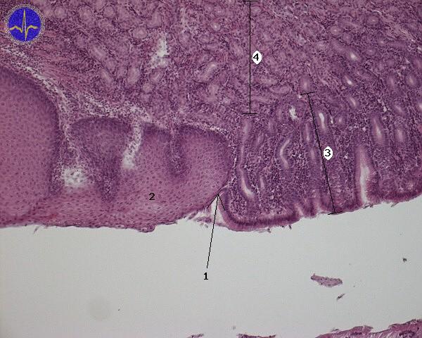 Gaster - cardia (SFLT) – WikiSkripta