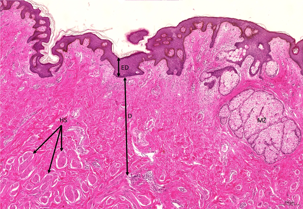 Scrotum / Pigmented skin of scrotum - HE – WikiSkripta