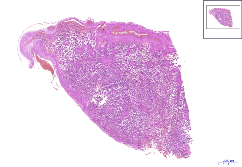 Placenta - HE – WikiSkripta