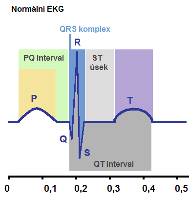 Popis EKG – WikiSkripta