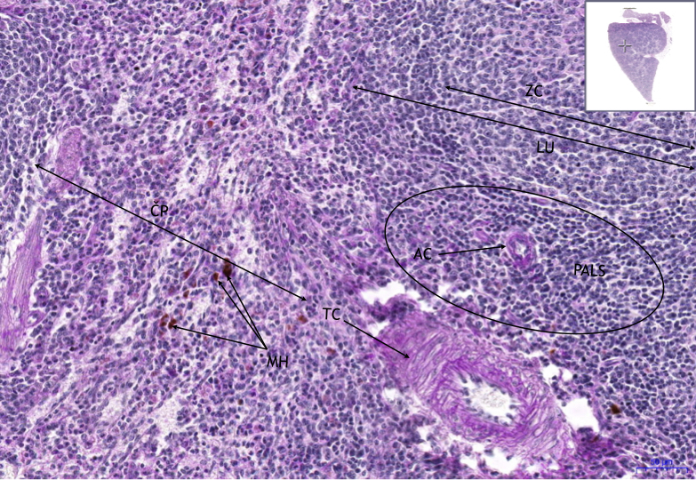 Slezina / Spleen - PAS – WikiSkripta