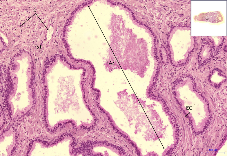 Prostata - HE – WikiSkripta