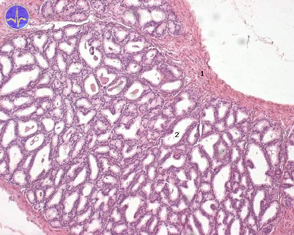 Vesicula seminalis (SFLT) – WikiSkripta