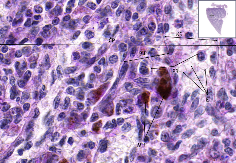 Slezina / Spleen - PAS – WikiSkripta